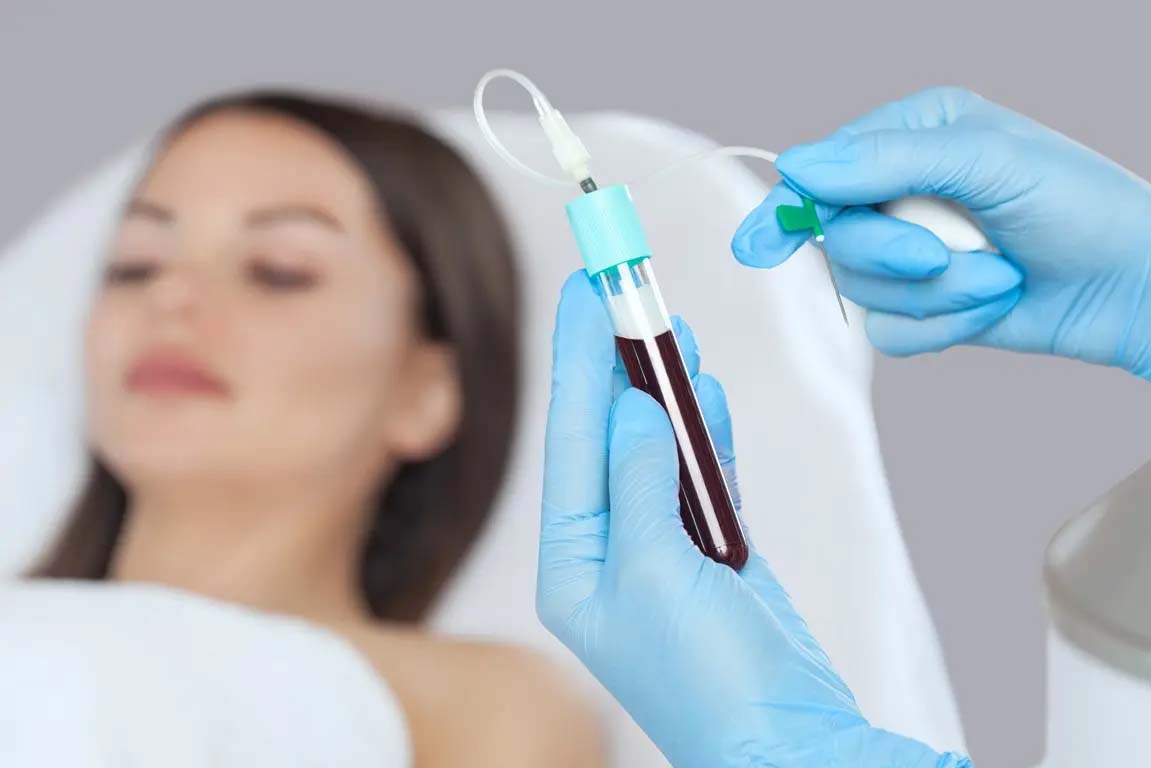 Vampire Lifting: alle Infosꟾ FineSkin